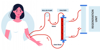REDIAL-redefining hemodialysis with data-driven materials innovation ...
